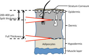 8.5 Dermal Absorption – Bioavailability of Contaminants in Soil ...